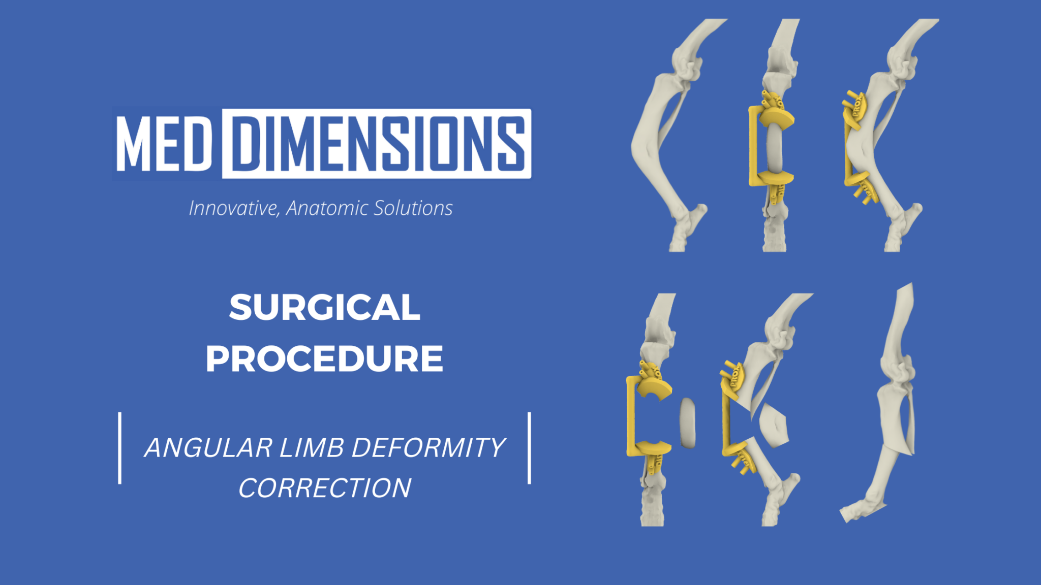 Angular Limb Deformity – Med Dimensions